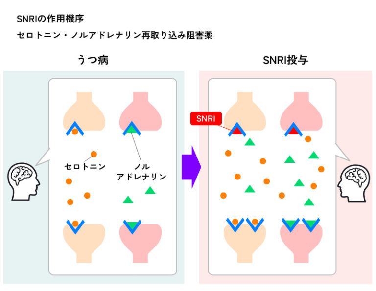 うつ病の薬物療法 - 佐藤病院（精神科・内科）